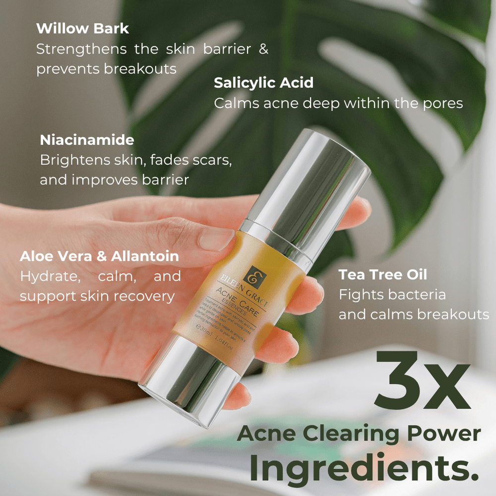 Eileen Grace Acne Care Essence 30ml – Fast-Acting Serum for Pimples
